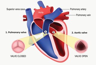 Ross procedure: Is this advanced aortic valve replacement right for you ...