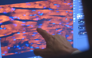 Helping the heart heal itself: The science of regeneration | Discovery ...