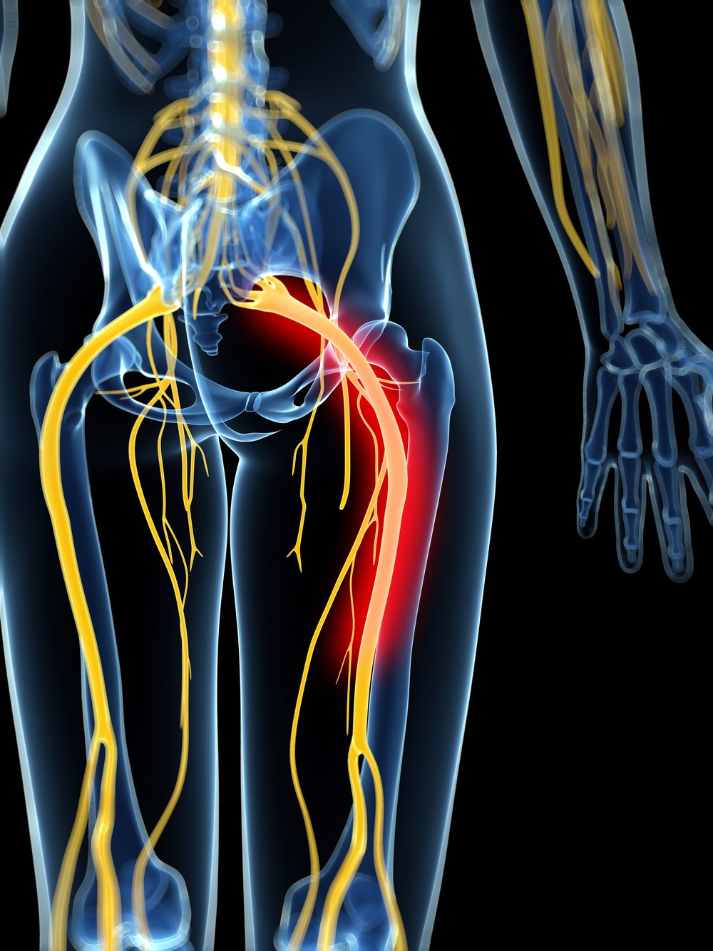 Sciatica in pregnancy: When it's more than the usual aches and pains ...