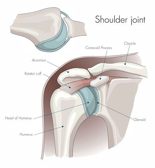 Torn rotator cuff: Symptoms, diagnosis, and treatment options ...