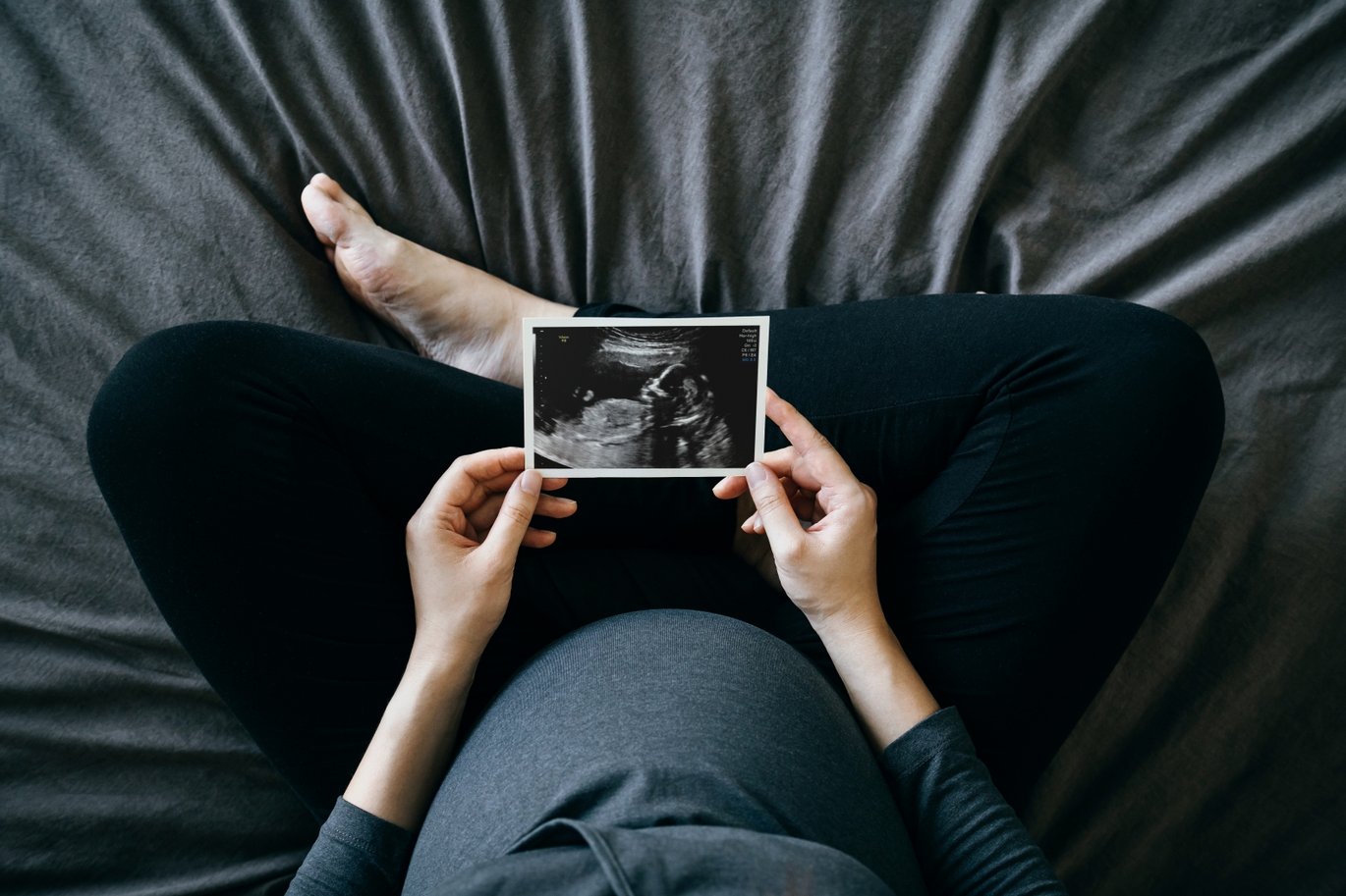 Can you test for autism during pregnancy? What you need to know | Your ...