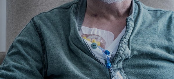 Chemotherapy | Conditions & Treatments | UT Southwestern Medical Center