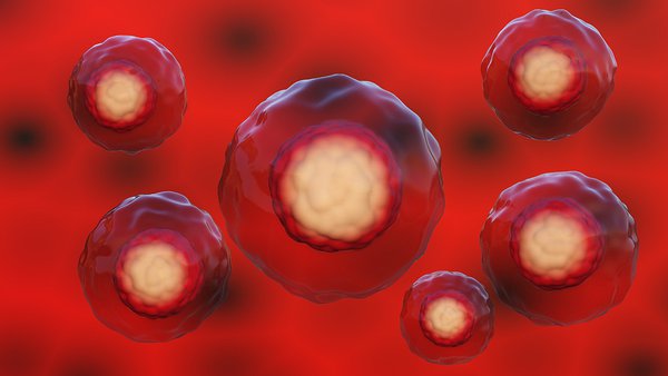 Blood Cancers/Transplant and Cellular Therapies Clinic | Dallas, Texas ...