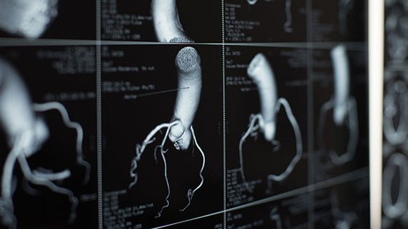 6 key heart tests and what they show | UTSW Medblog