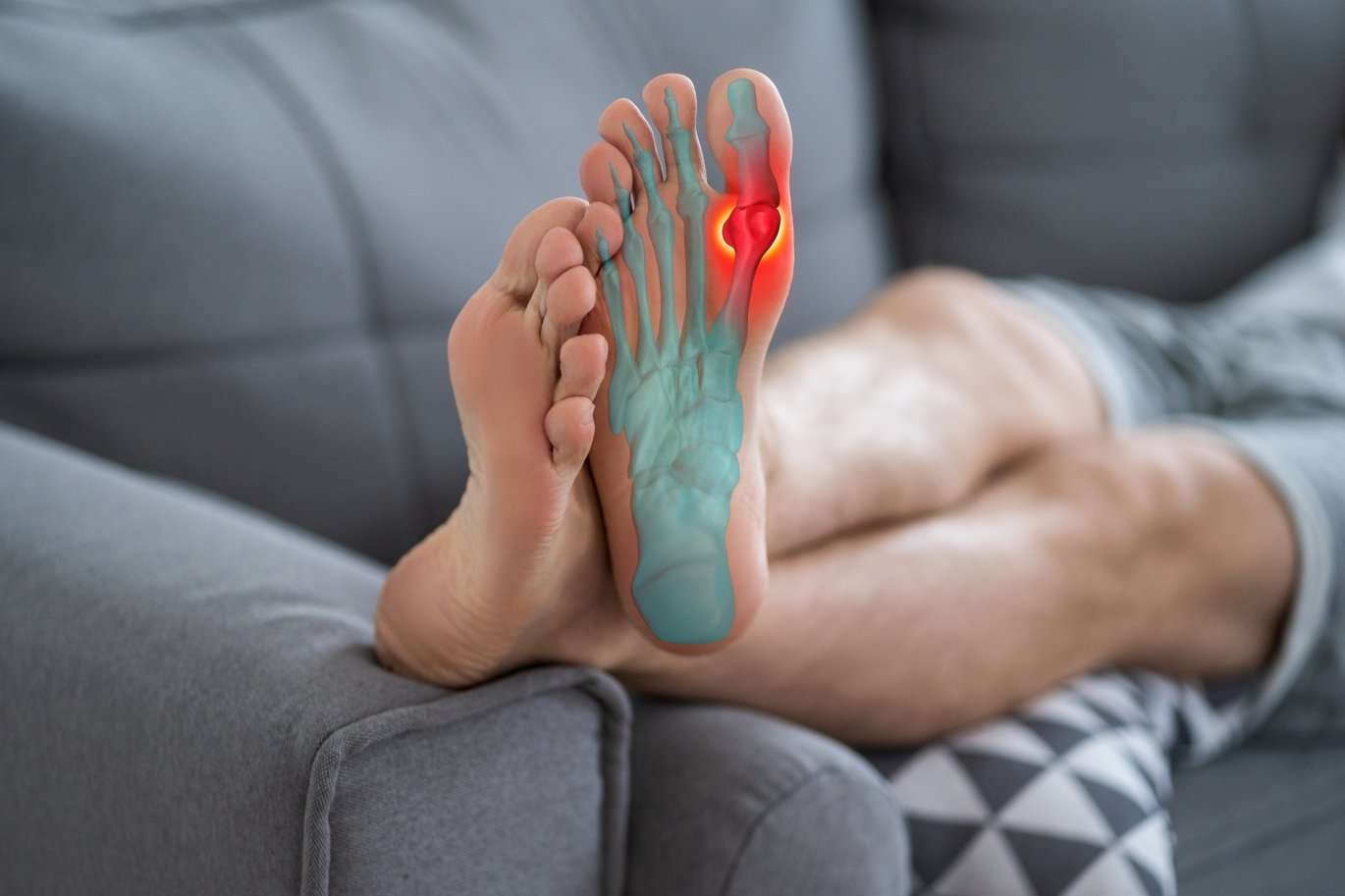 Turf toe: What athletes need to know about this painful injury ...