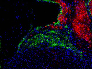Helping the heart heal itself: The science of regeneration | Discovery ...