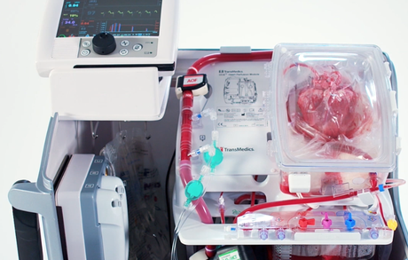 ‘Heart in a box’ technology expands transplant capabilities | Heart ...
