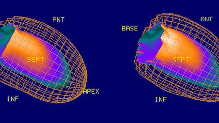 6 key heart tests and what they show | UTSW Medblog
