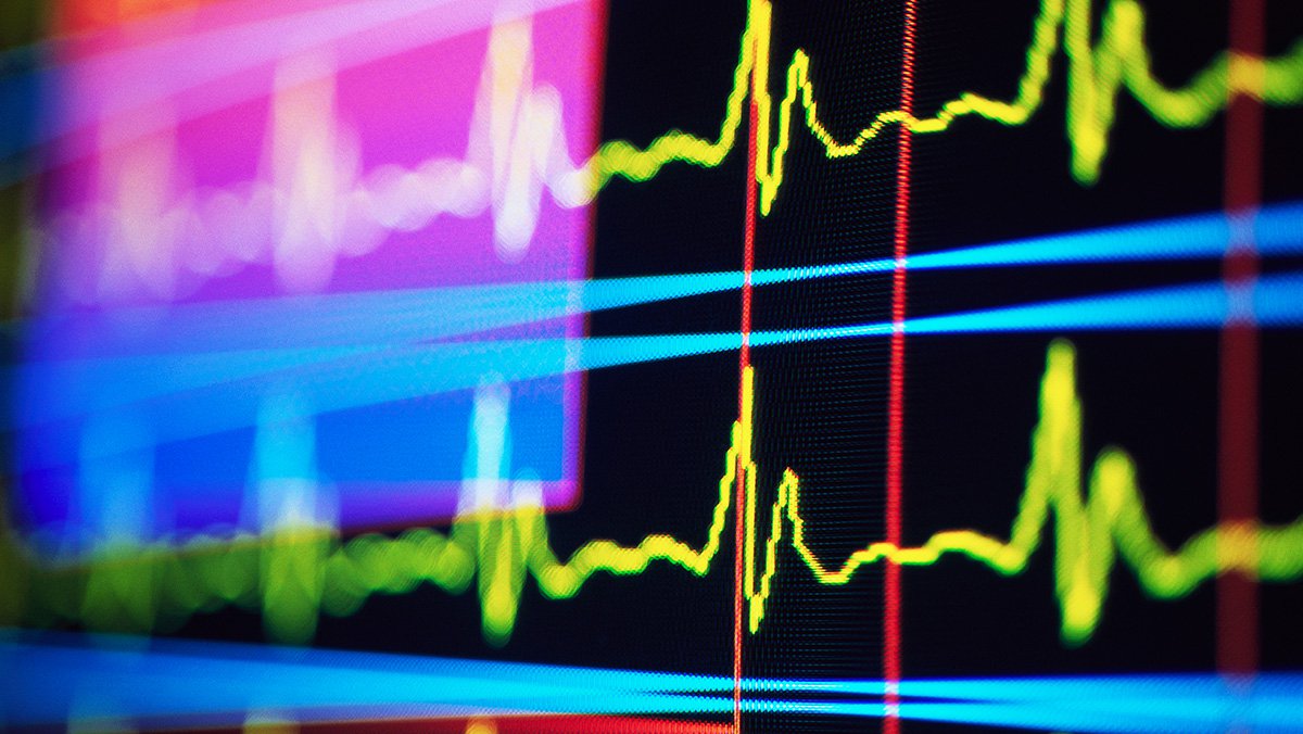 Cardiology | Dallas, Texas | UT Southwestern Medical Center